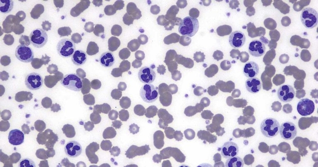 Marked neutrophilia in a dog